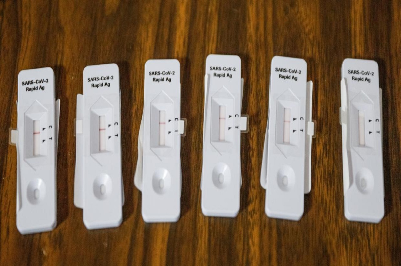Ακριβαίνουν self test, rapid test και PCR – Η εγκύκλιος της ΑΑΔΕ - FORMedia